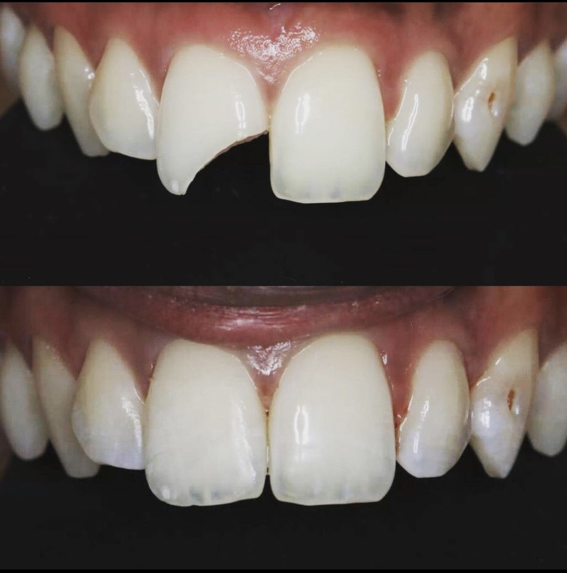 Portfolio – daveshdentistry